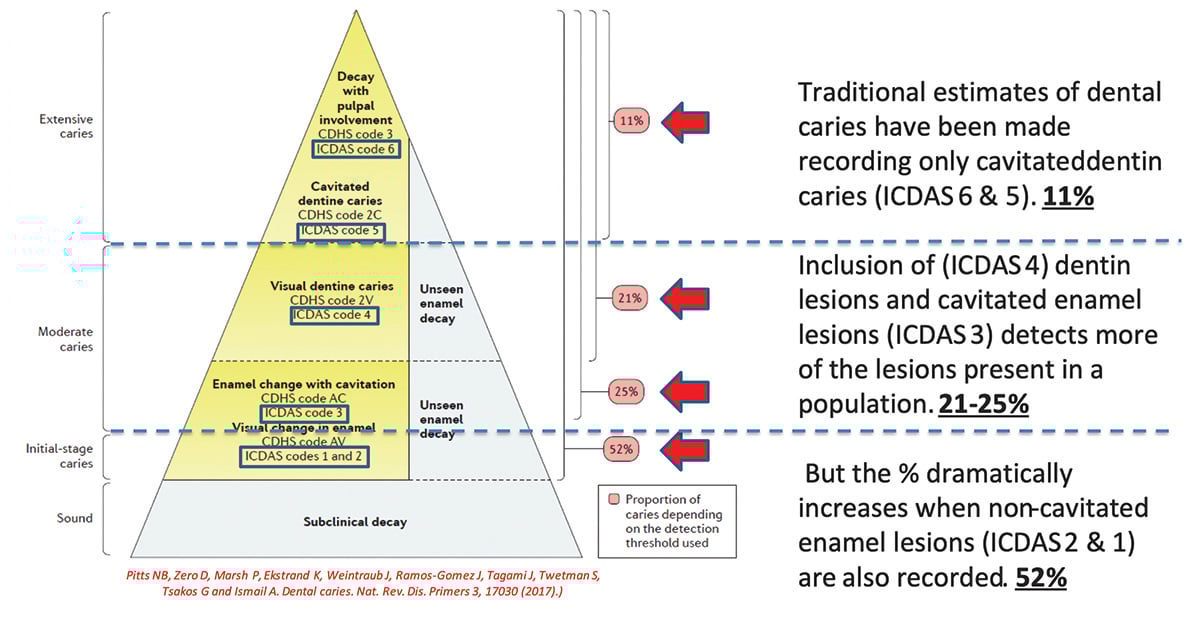Caries Overview 2021: Epidemiology, Etiology, and Evidence-Into-Action ...