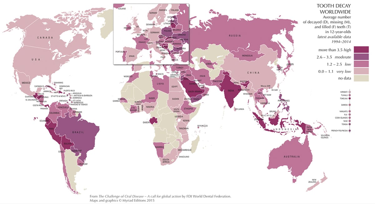 Caries Overview 2021: Epidemiology, Etiology, and Evidence-Into-Action ...