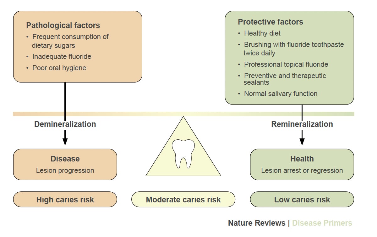 Caries Overview 2021: Epidemiology, Etiology, and Evidence-Into-Action ...