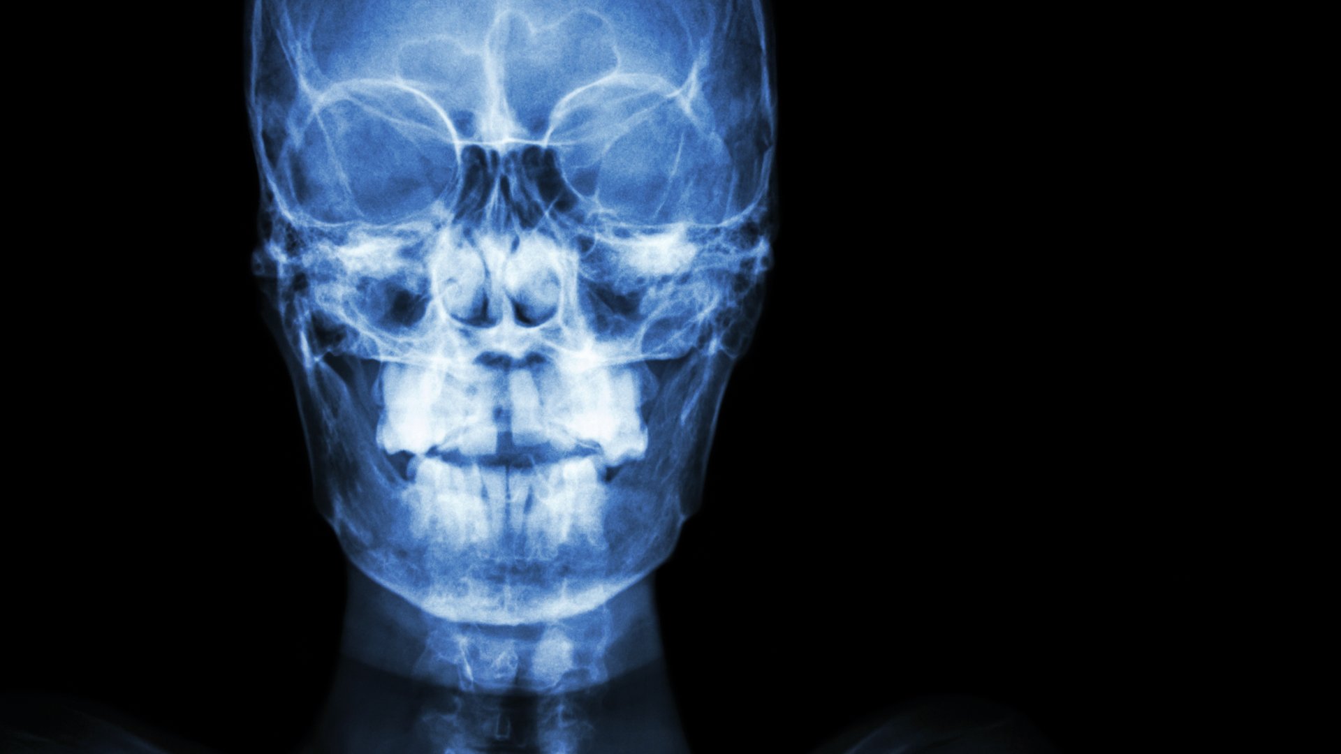 Oral and Maxillofacial Radiology - December 10, 2019