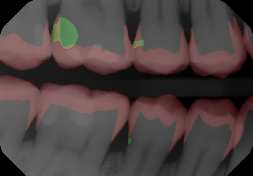 JADA+: Artificial Intelligence in Dentistry