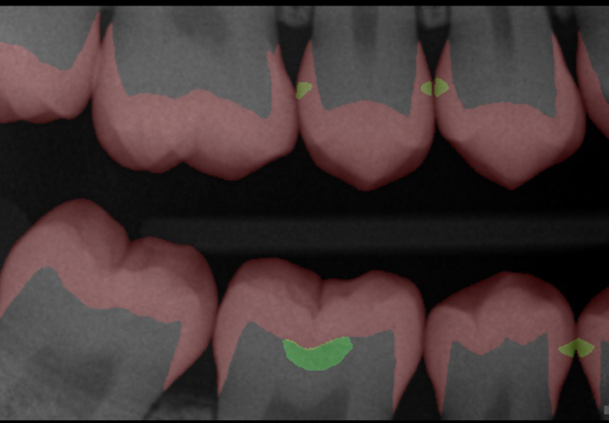 JADA+: Artificial Intelligence in Dentistry