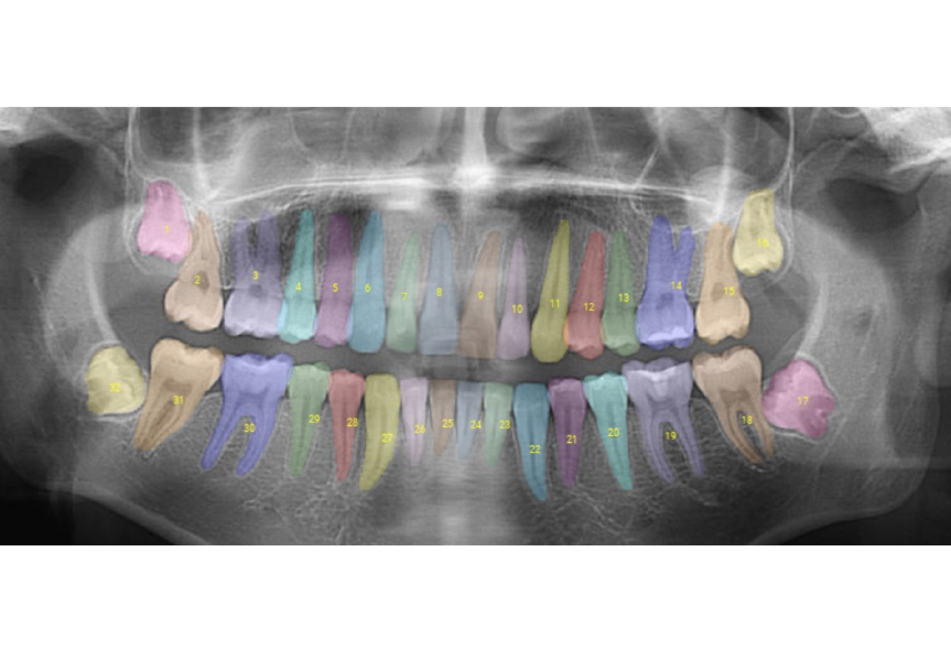 JADA+: Artificial Intelligence in Dentistry