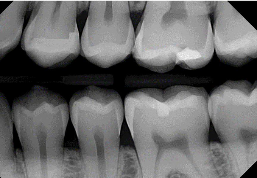 JADA+: Artificial Intelligence in Dentistry