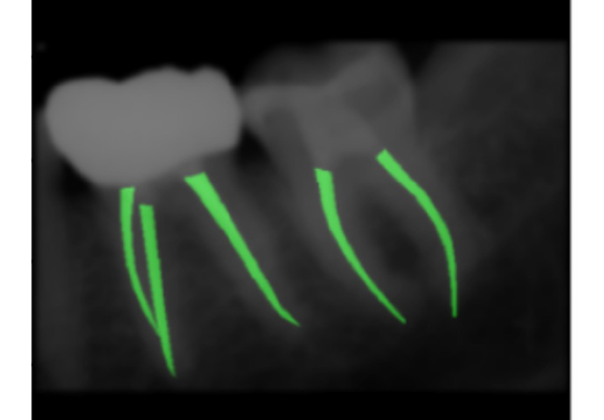 JADA+: Artificial Intelligence in Dentistry