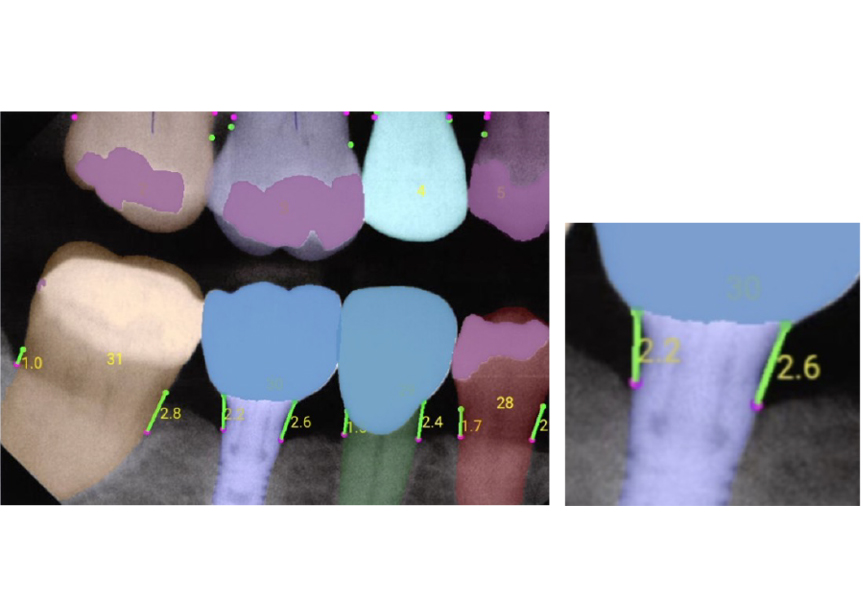 JADA+: Artificial Intelligence in Dentistry
